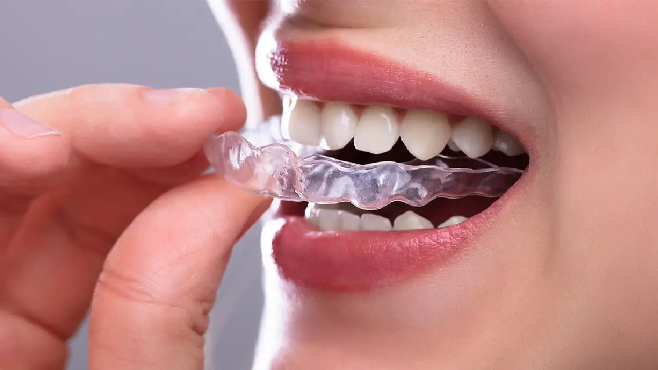 Can Invisalign Help With Sleep Apnea?